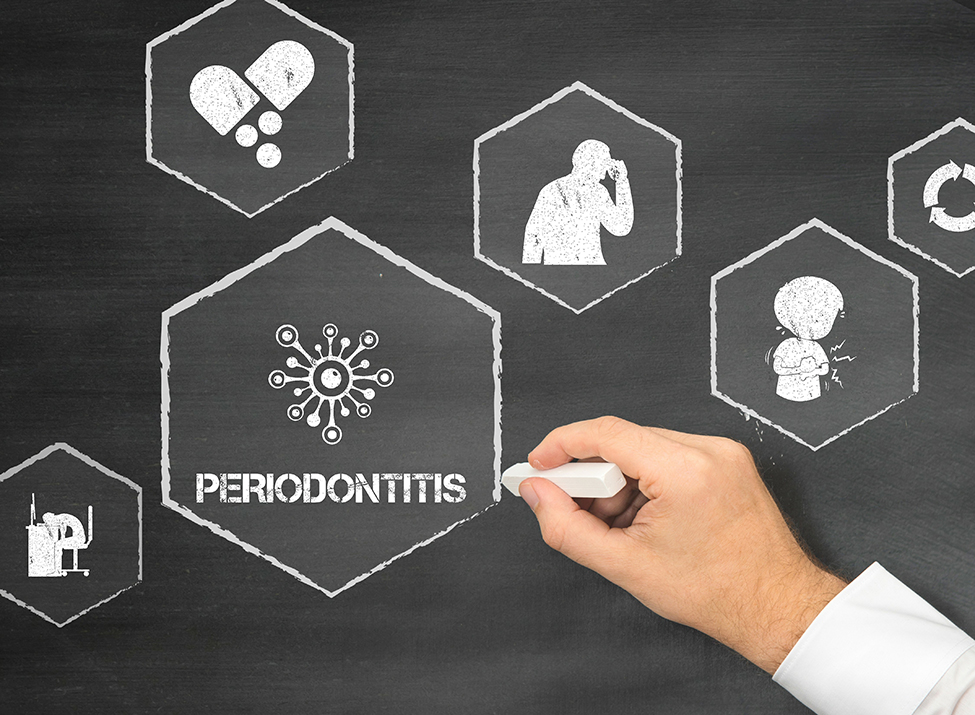 Growing evidence on periodontal and systemic disease links – ODHA ...