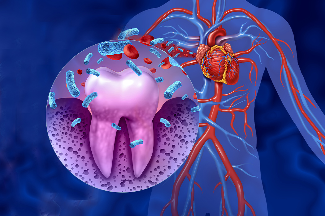 Oral health and atherosclerotic cardiovascular disease – ODHA Dental ...