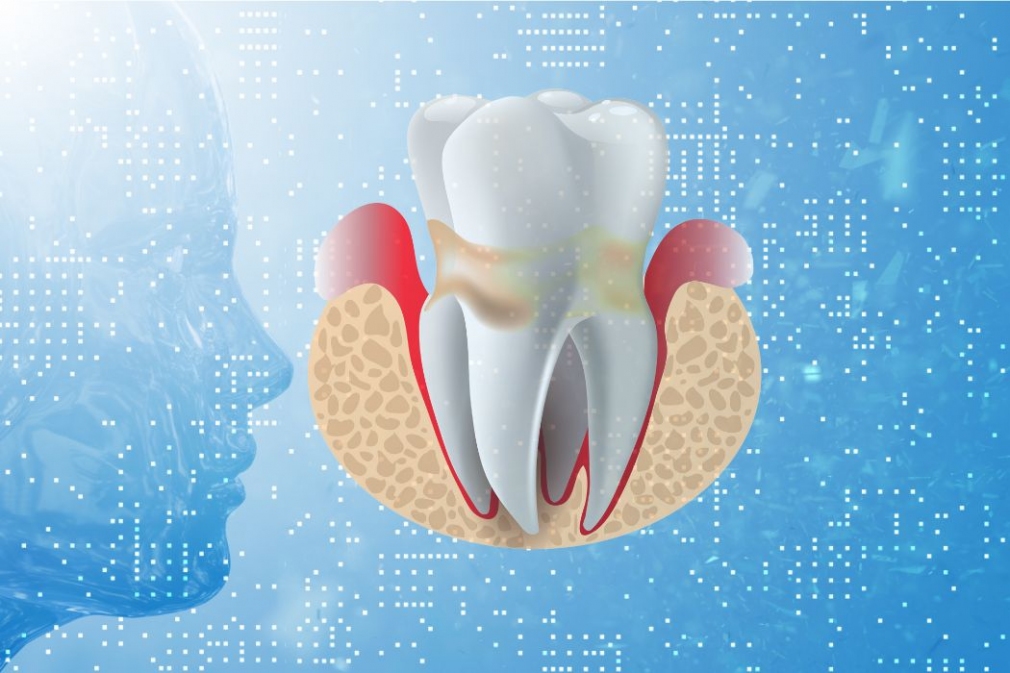 ODHA Dental Hygiene Newswire – News and research for Ontario dental ...